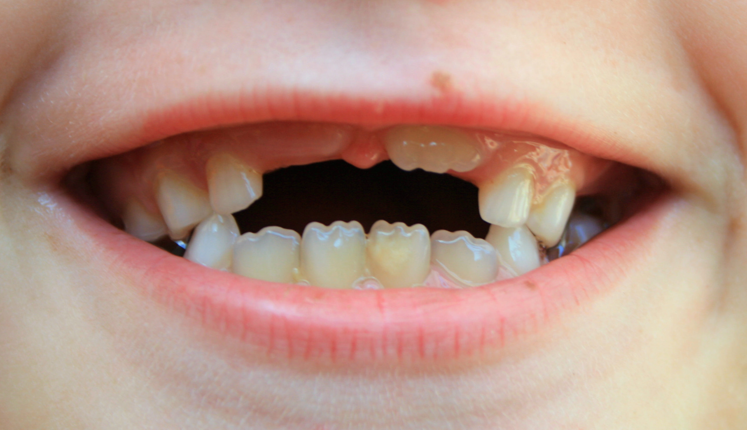 Otvorena Stomatološka poliklinika Rident i u Poreču - MojaRijeka